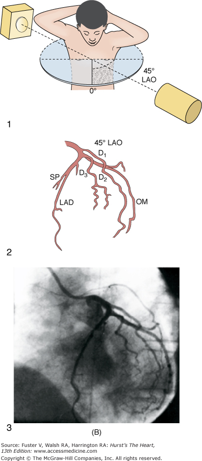 Cardiac Catheterization, Cardiac Angiography, and Coronary Blood Flow ...