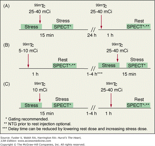 Nuclear Cardiology | Thoracic Key