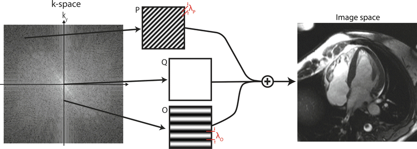 k-Space | Thoracic Key