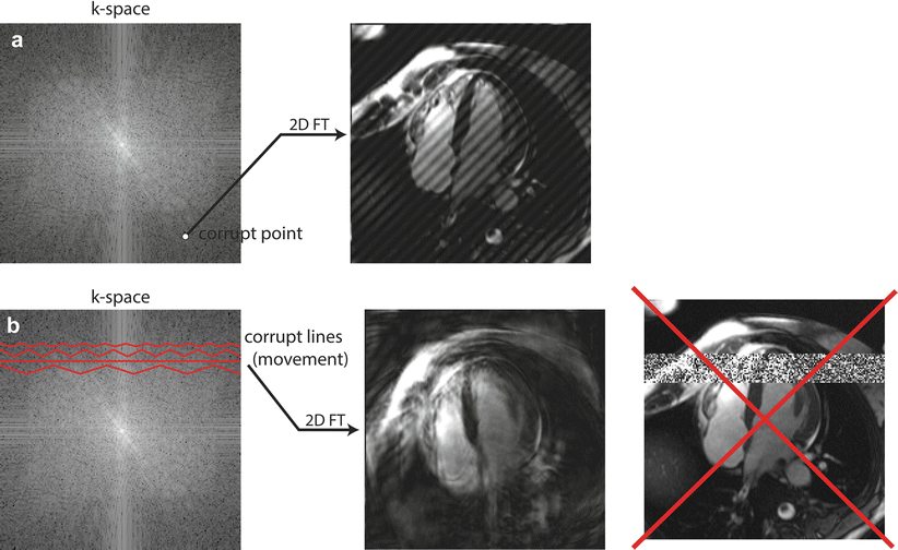 k-Space | Thoracic Key