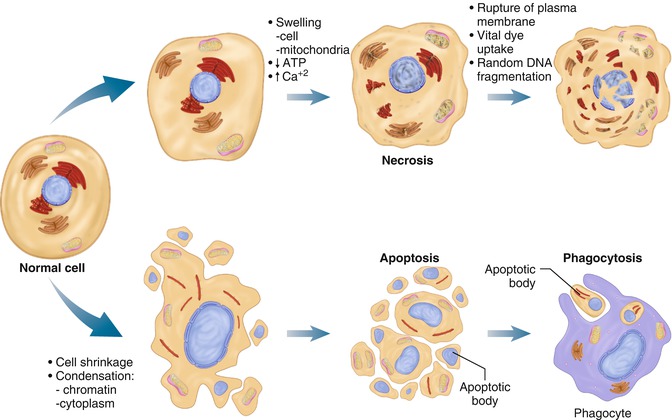 The Mechanisms and Modalities of Cell Death | Thoracic Key