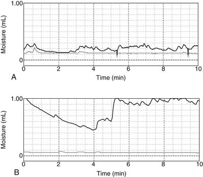 Surgical Treatment of Hyperhidrosis | Thoracic Key
