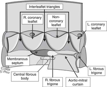 Surgical Anatomy of the Heart | Thoracic Key
