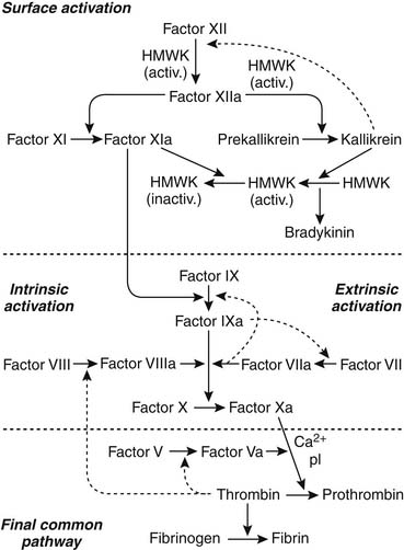 Management of Native Valve Endocarditis | Thoracic Key