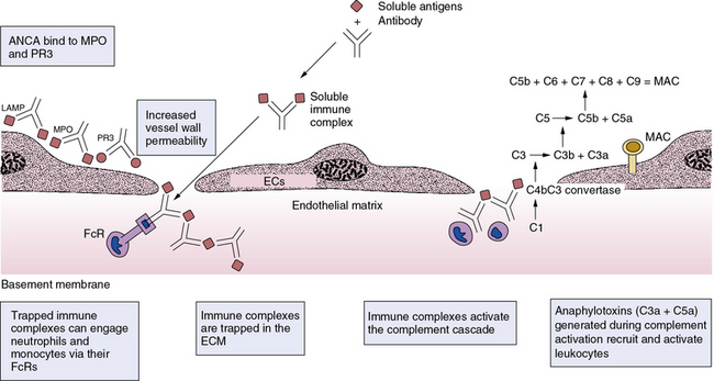 Pathophysiology of Vasculitis | Thoracic Key