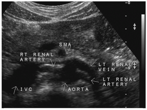 Abdominal Vasculature | Thoracic Key