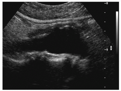 Abdominal Vasculature | Thoracic Key