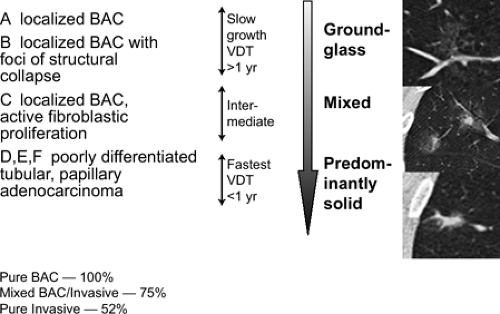 Focal Lung Disease | Thoracic Key