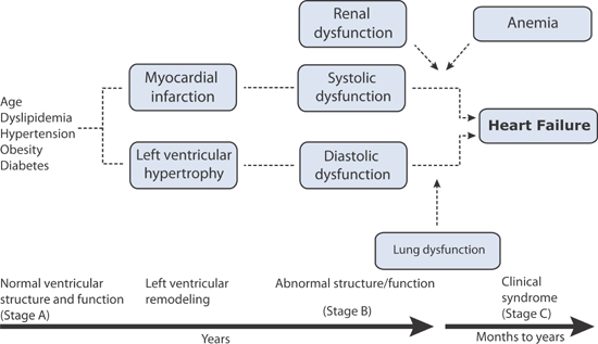 STAGE B: ASYMPTOMATIC STRUCTURAL HEART DISEASE | Thoracic Key