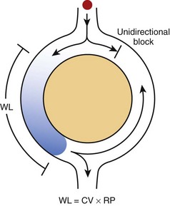 Mechanisms of Re-entrant Arrhythmias | Thoracic Key