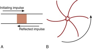 Mechanisms of Re-entrant Arrhythmias | Thoracic Key