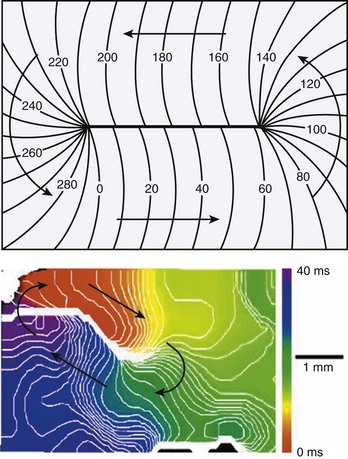 Mechanisms of Re-entrant Arrhythmias | Thoracic Key