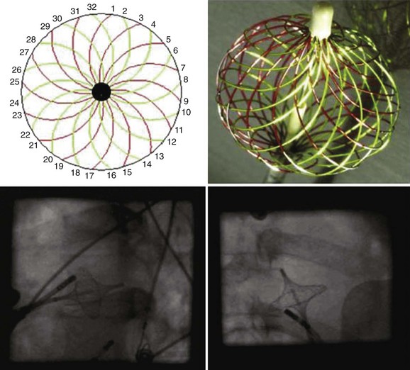 Electrophysiological Evaluation of Atrial Fibrillation | Thoracic Key