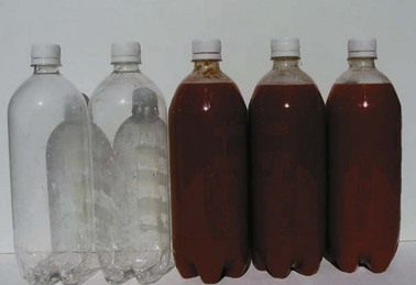 Shock, Electrolytes, and Fluid | Thoracic Key