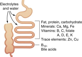 Small Intestine | Thoracic Key