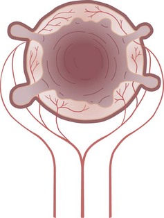 Colon and Rectum | Thoracic Key
