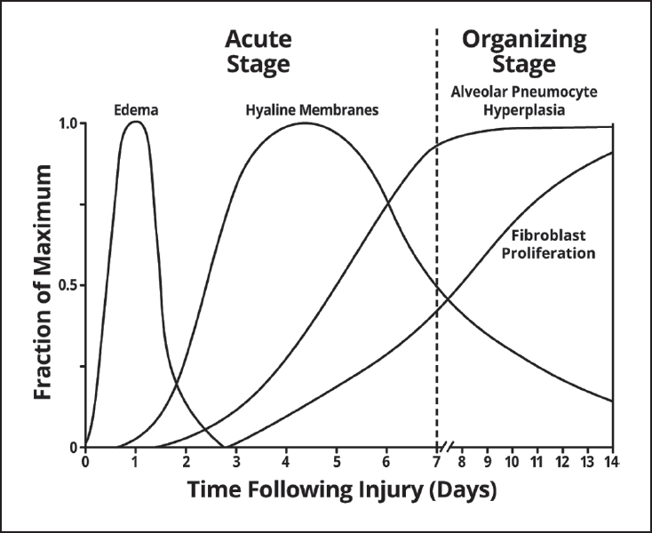 Diffuse Alveolar Damage, Acute Interstitial Pneumonia | Thoracic Key