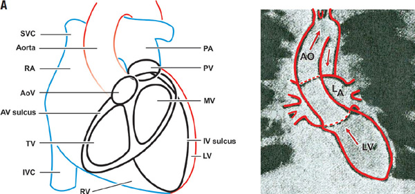 Left and Right Ventriculography, Aortography, and Pulmonary Angiography ...