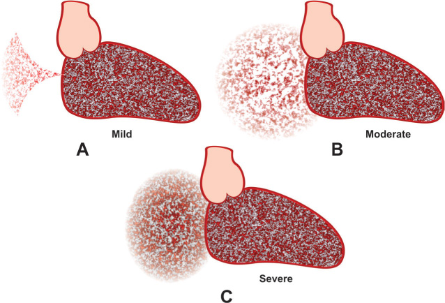 Left and Right Ventriculography, Aortography, and Pulmonary Angiography ...