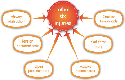 Blunt and Penetrating Injuries | Thoracic Key