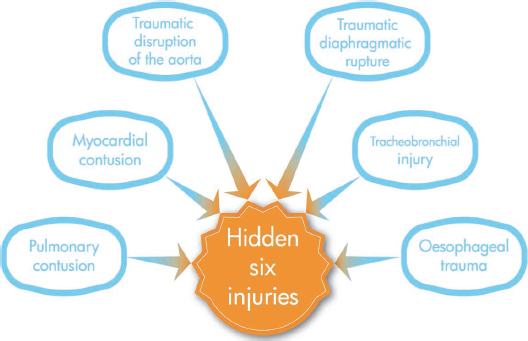 Blunt and Penetrating Injuries | Thoracic Key