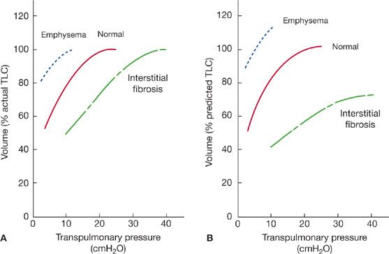 Pulmonary Function Testing | Thoracic Key