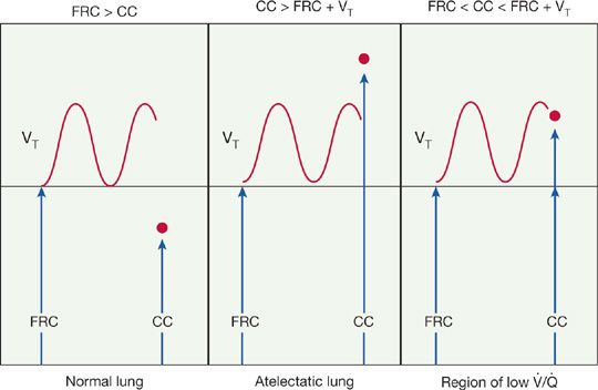 Perioperative Respiratory Considerations in the Surgical Patient ...