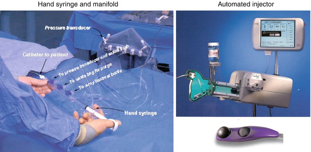 Coronary Angiography | Thoracic Key