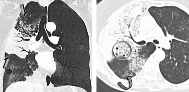 Diseases | Thoracic Key