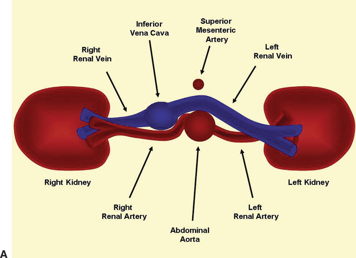 Renal Duplex Scanning | Thoracic Key